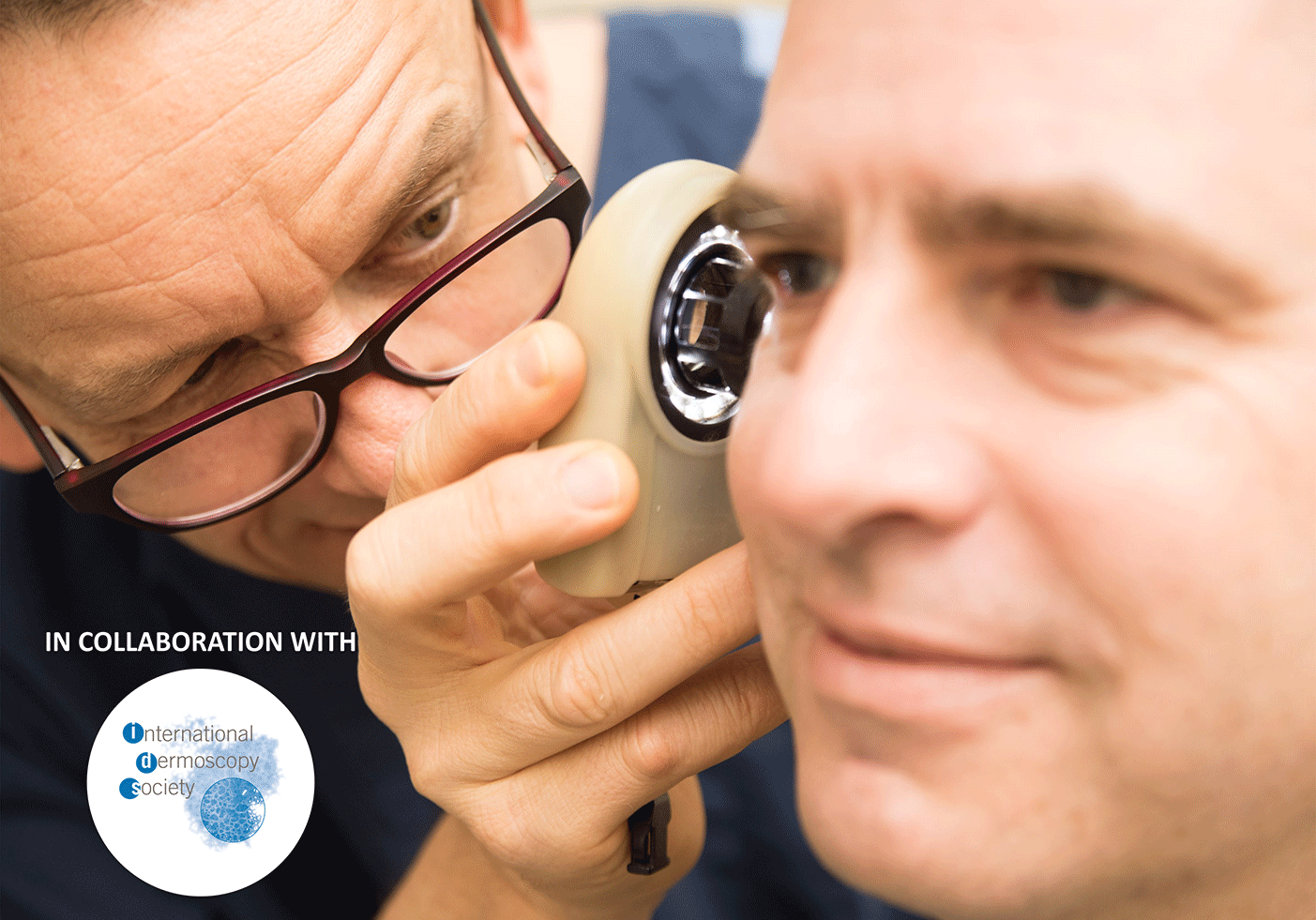 Free short course in dermoscopy